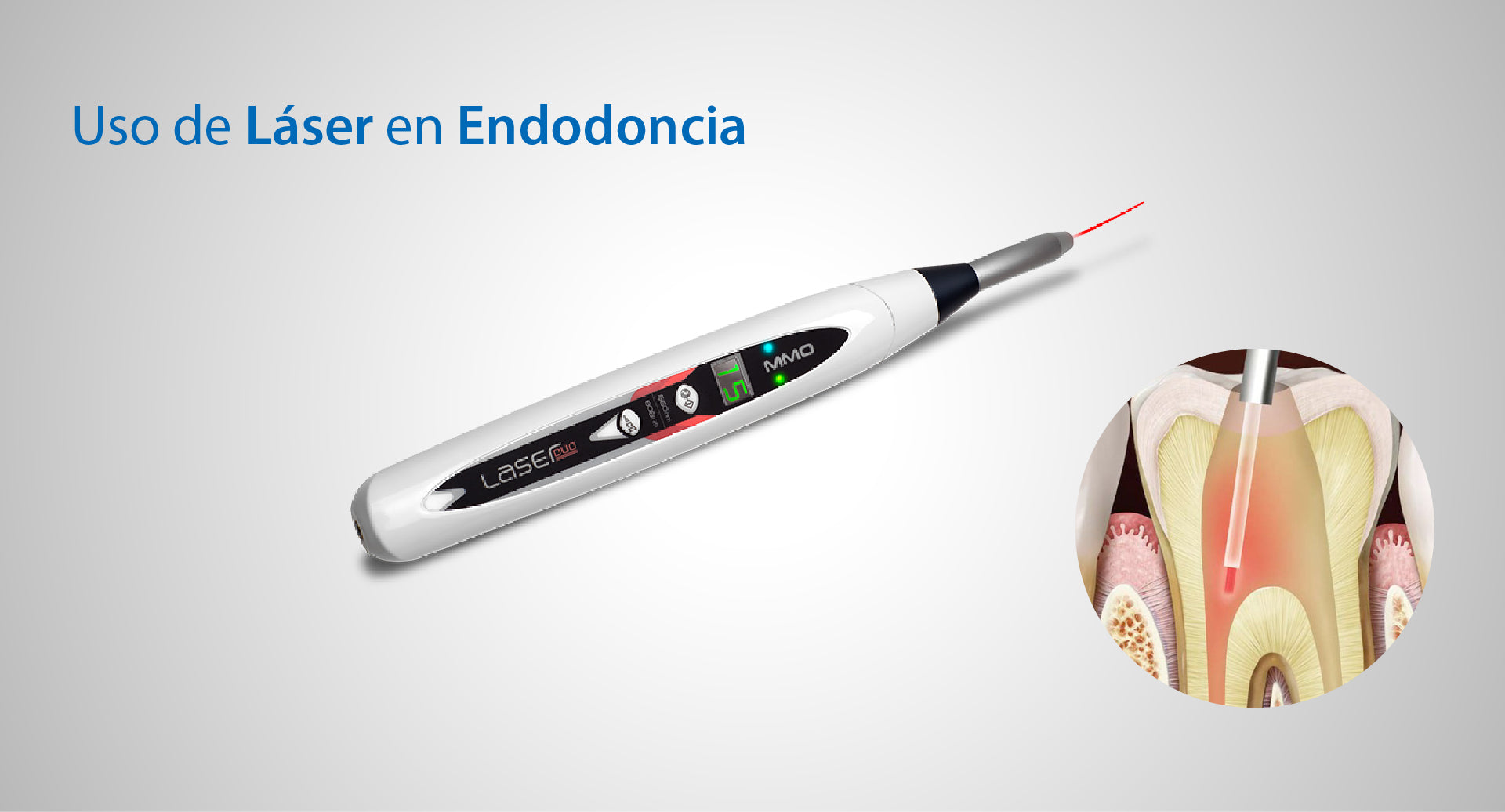 Uso de Láser Dental en Endodoncia
